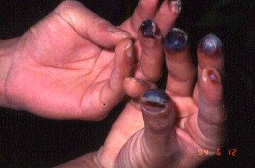 ENTREVISTA EXCLUSIVA: Elsa Ávila, a 25 años de ser la primera ...